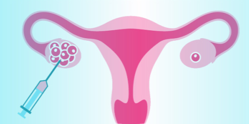 IVF Services Bangalore